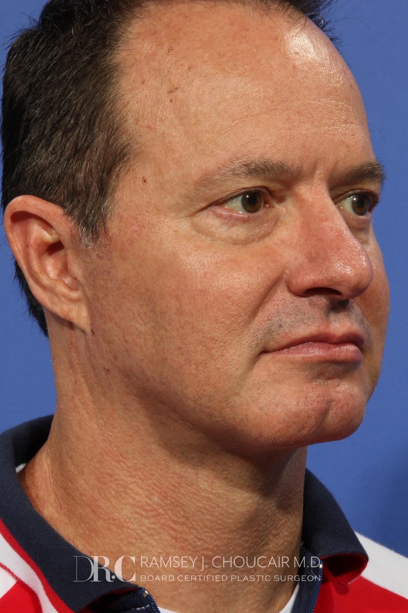 BA - Dr. Ramsey Choucair