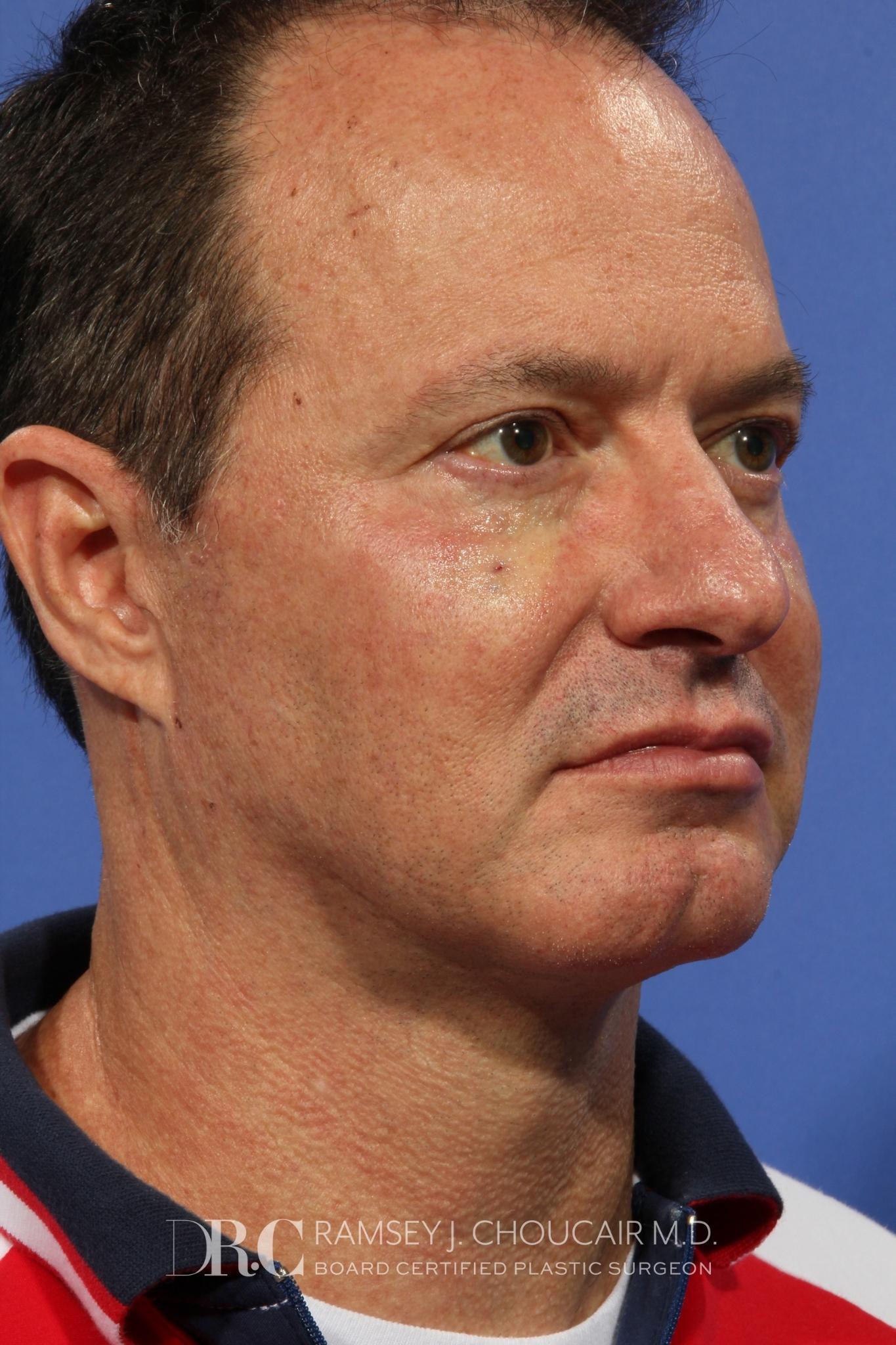 BA - Dr. Ramsey Choucair